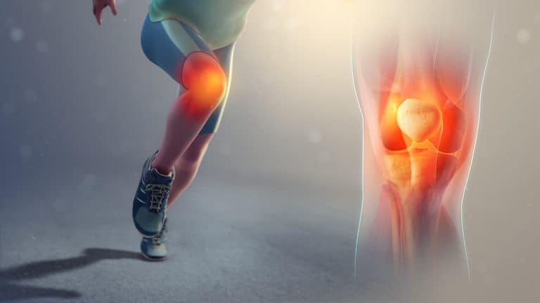 What Does Full-Thickness Cartilage Defect Mean, and What You Can Do ... What Does Full-Thickness Cartilage Defect Mean, and What You Can Do ...
