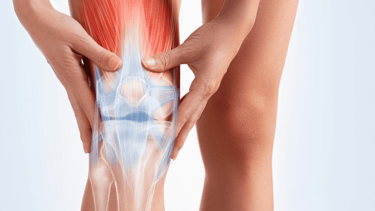 What Does Full-Thickness Cartilage Defect Mean, and What You Can Do ... What Does Full-Thickness Cartilage Defect Mean, and What You Can Do ...
