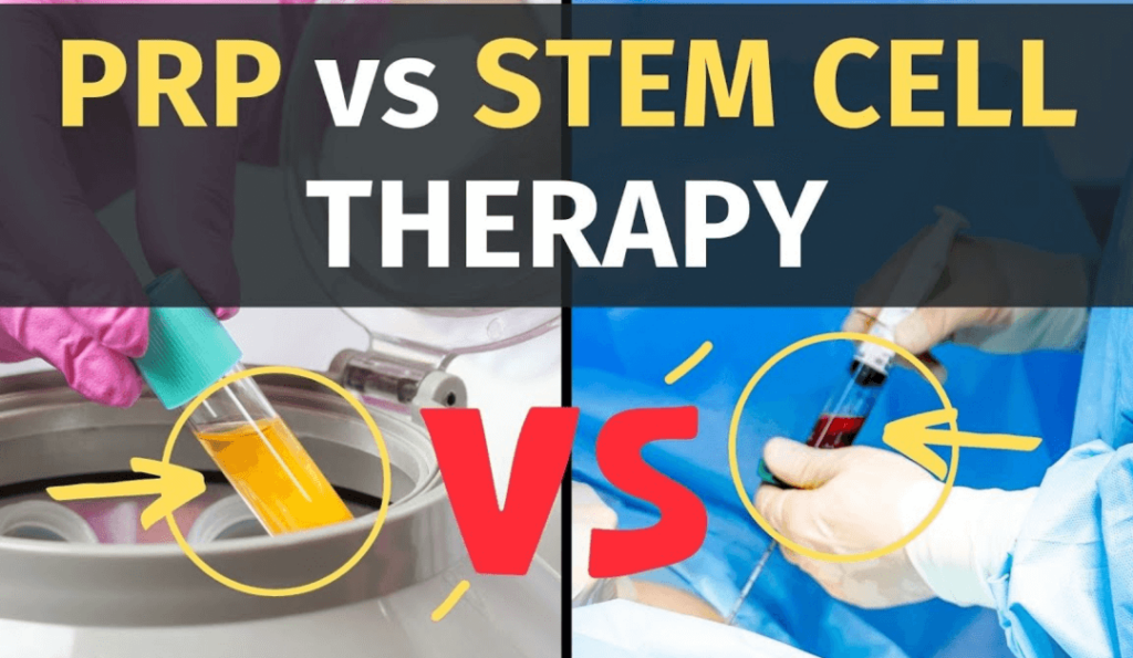 Which is Better, PRP or Stem Cell Therapy? | RegeneVive Health and Wellness