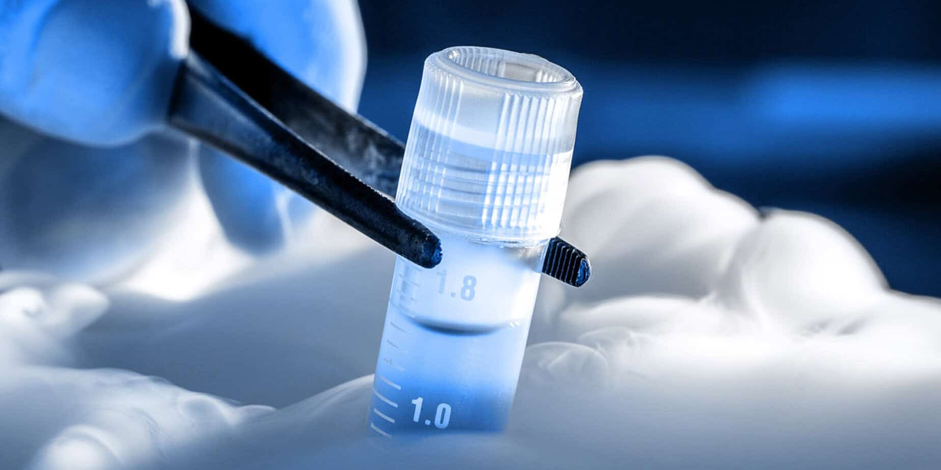 Stem Cell Treatment for Liver Cirrhosis in the USA - RegeneVive